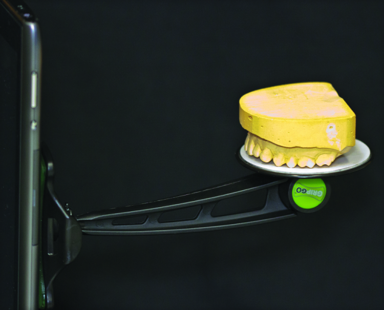 Dental News - The Virtual Facebow: A digital companion to implantology