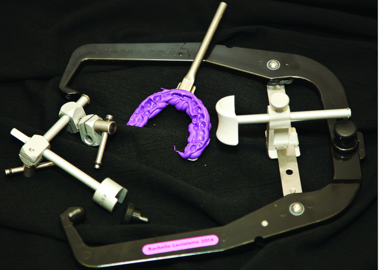 Dental News - The Virtual Facebow: A digital companion to implantology