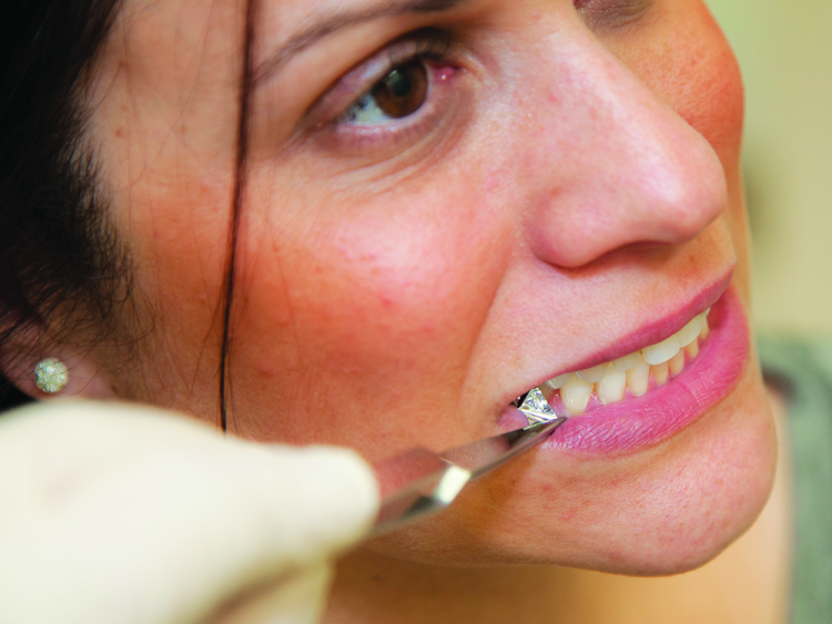 Dental News - The Virtual Facebow: A digital companion to implantology