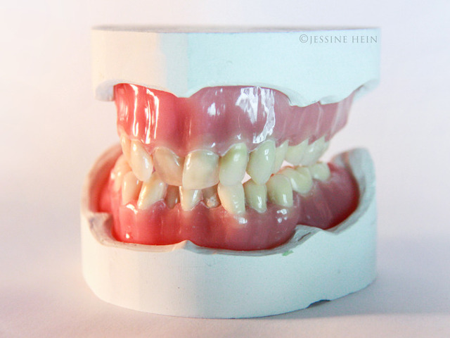 Dental News - Interview: “Bowie’s teeth were like everything else about ...
