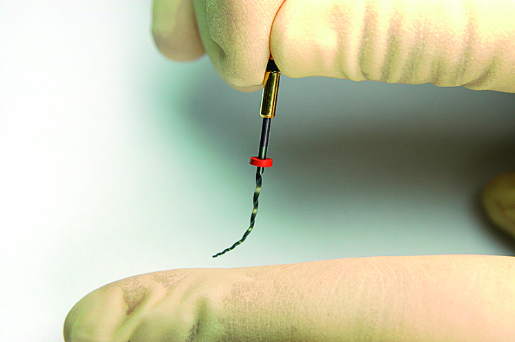 Dental News - A short history of the NiTi file revolution