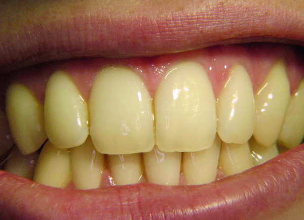 DT News - France - Ce que nos dents disent de nous — Partie I