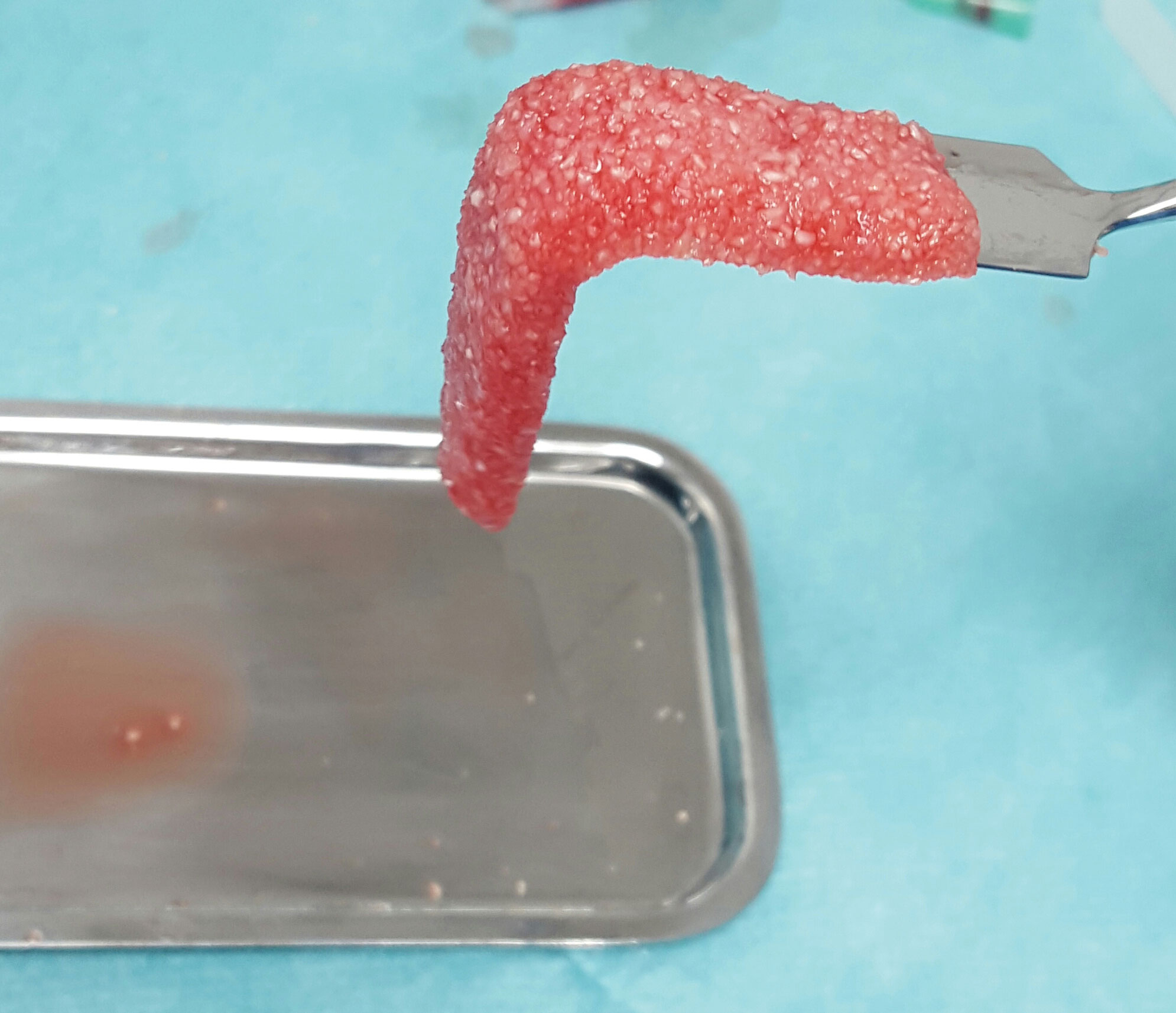 Dental News - PRF brings new challenges to the dental office