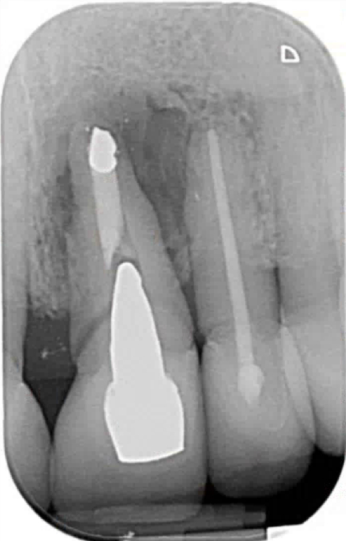 Dental News - Mastering the implant digital workflow
