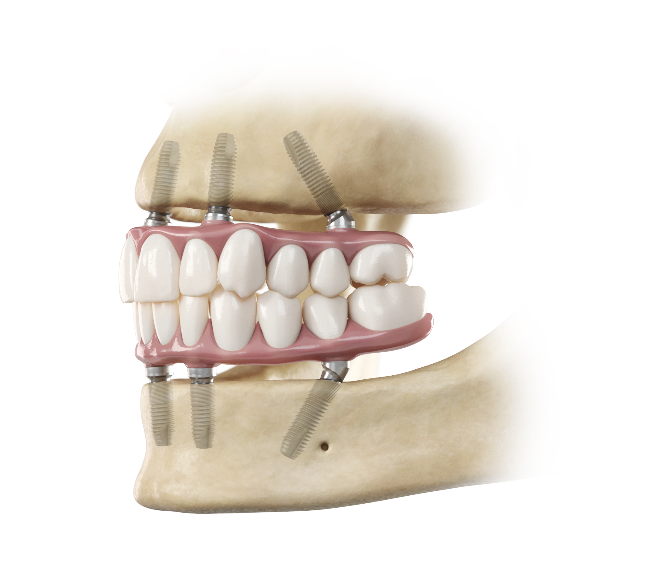 DT News - MEA - Simplicity without compromise with the Astra Tech ...