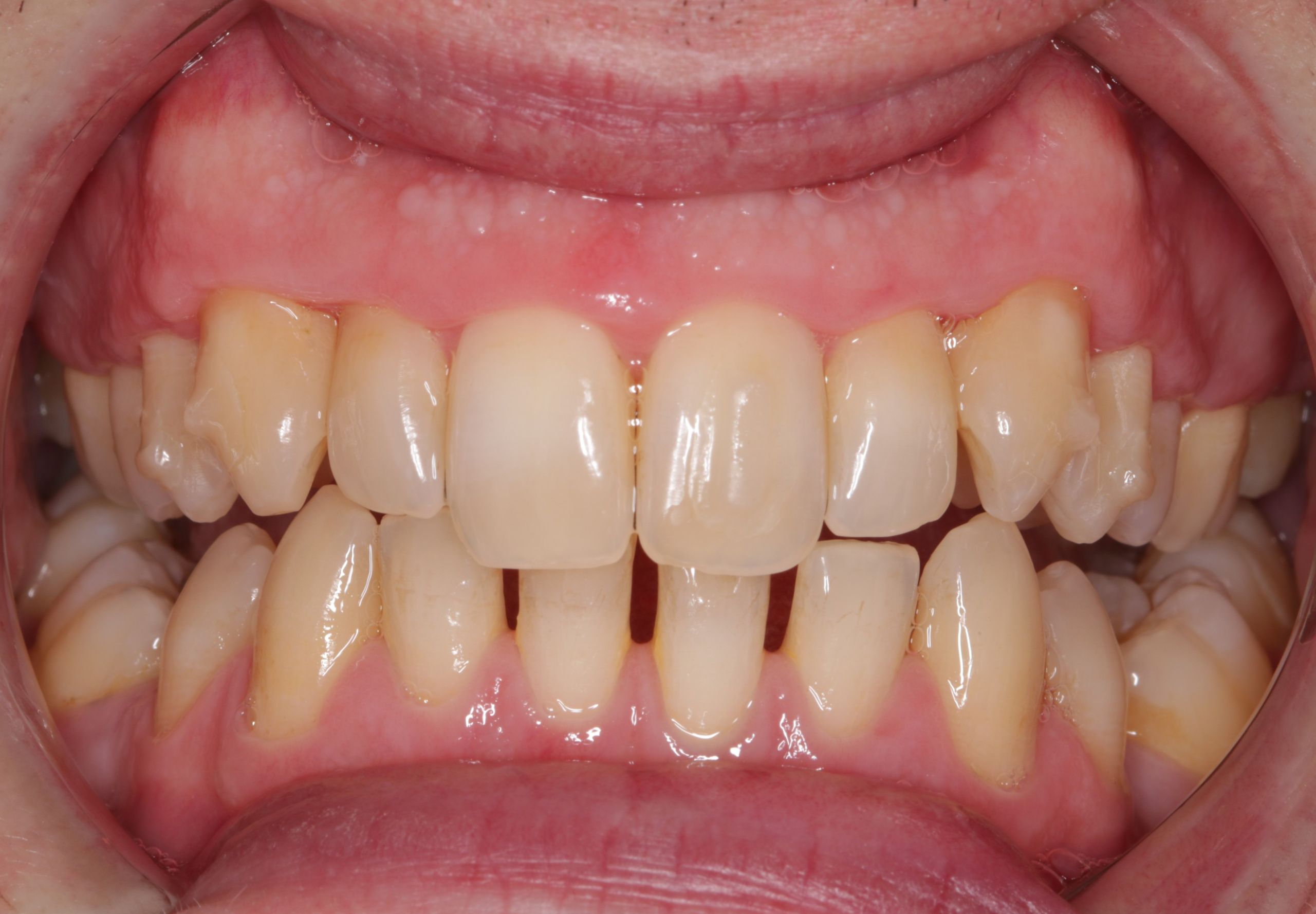 Dental News - Getting to grips with general dental practitioner ...