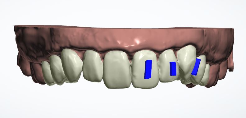 Dental News - Getting to grips with general dental practitioner ...