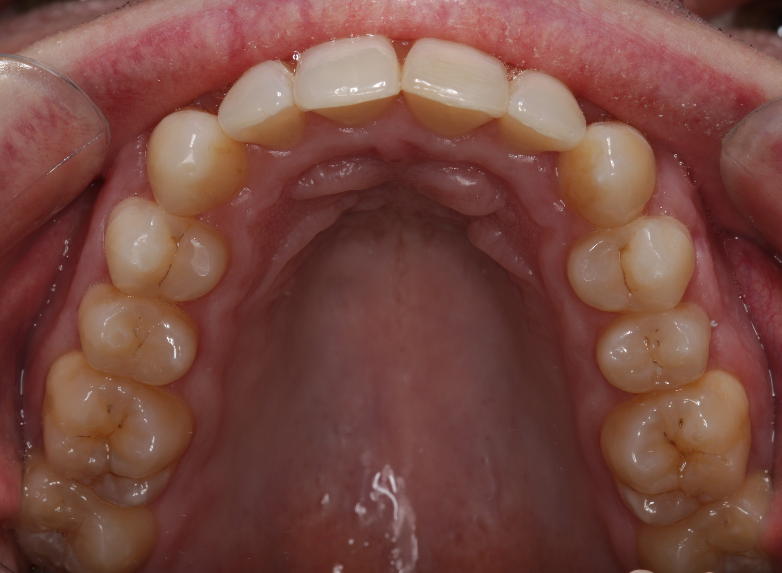 Dental News - Getting to grips with general dental practitioner ...