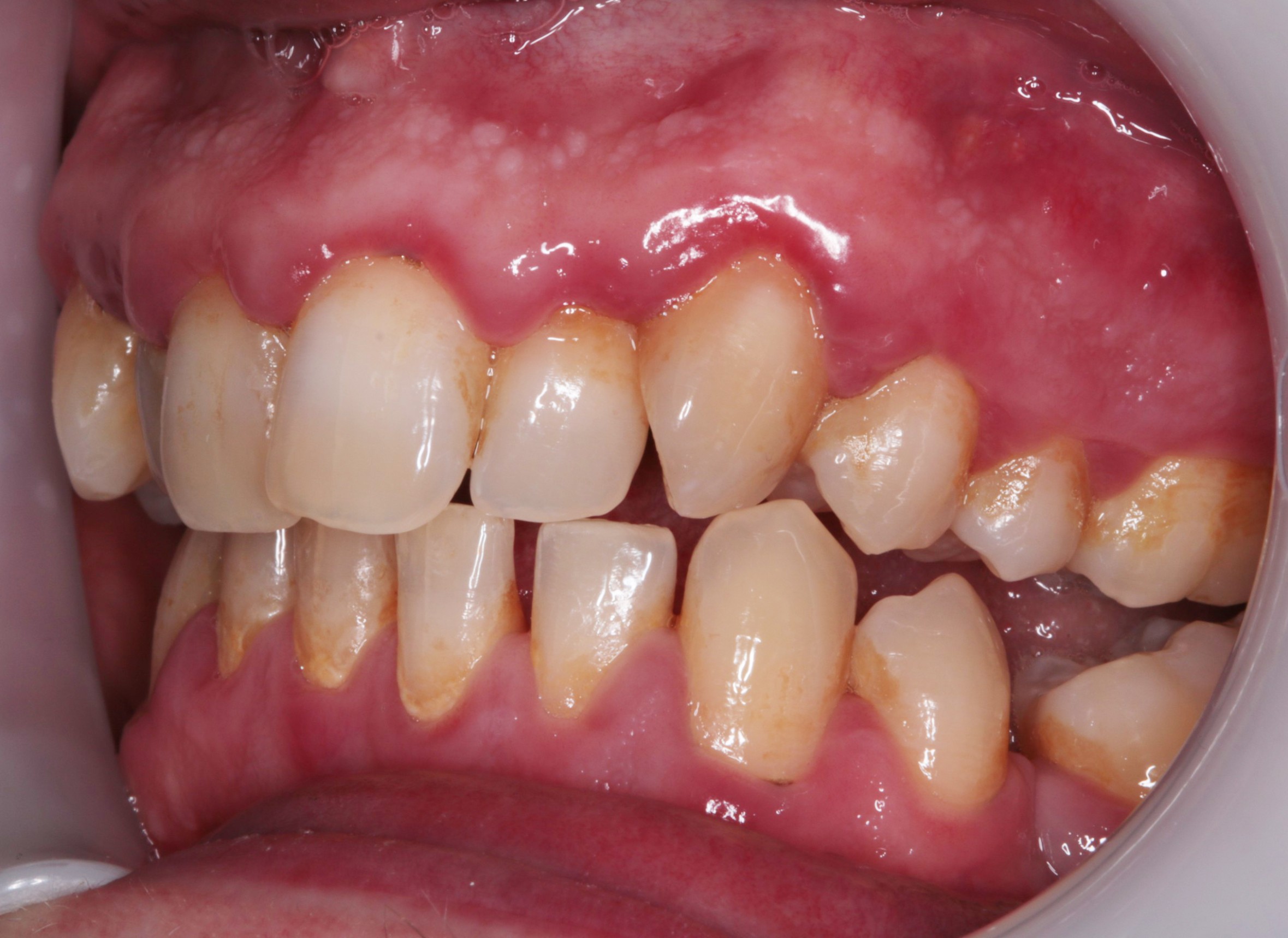 Dental News - Getting to grips with general dental practitioner ...