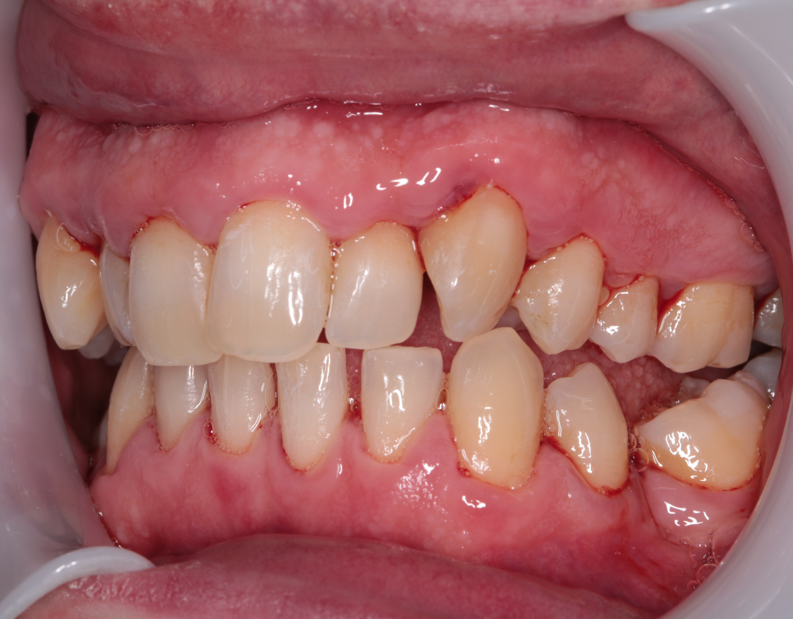 Dental News - Getting to grips with general dental practitioner ...