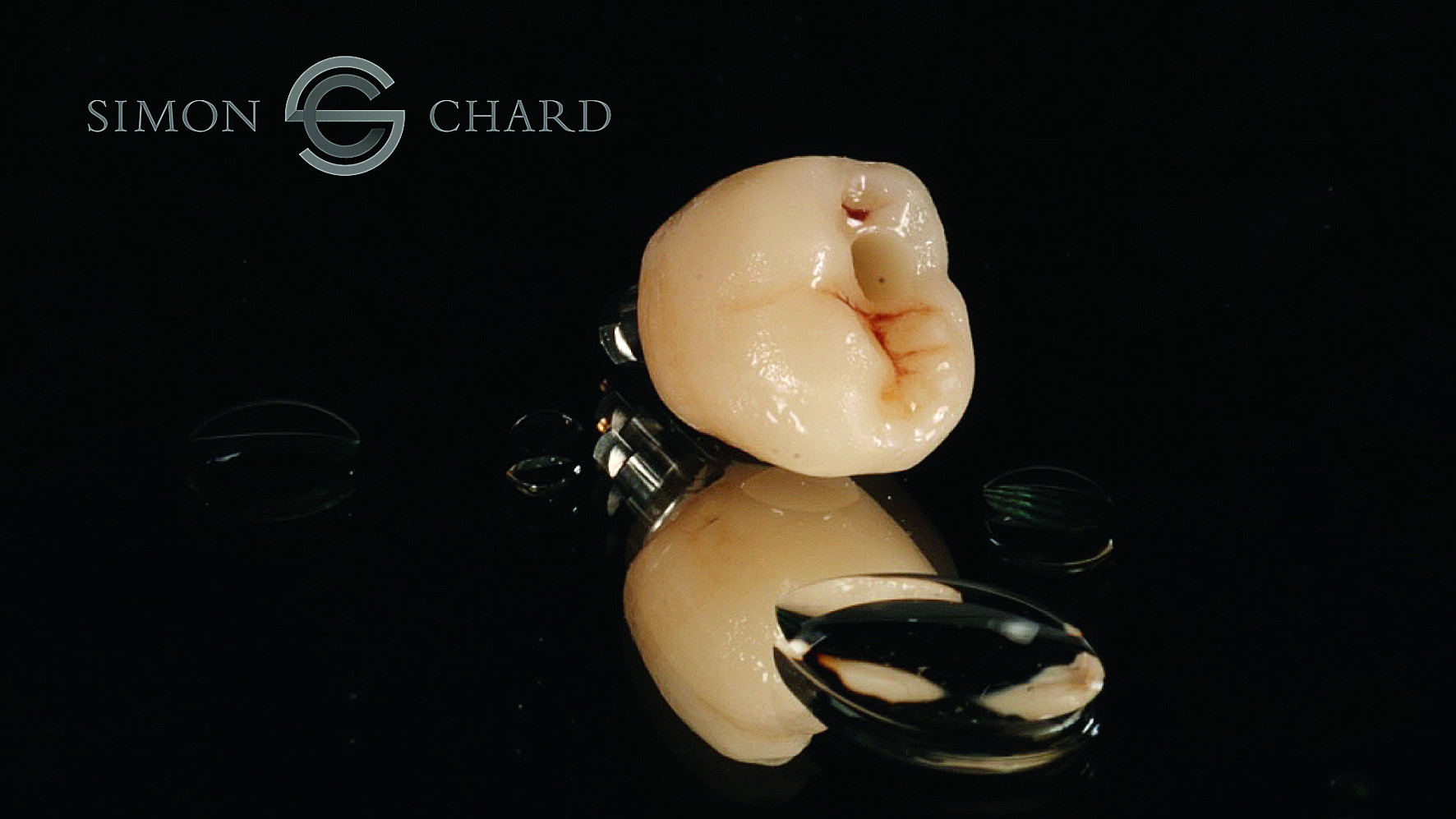 Dental News - Implant restoration with CEREC