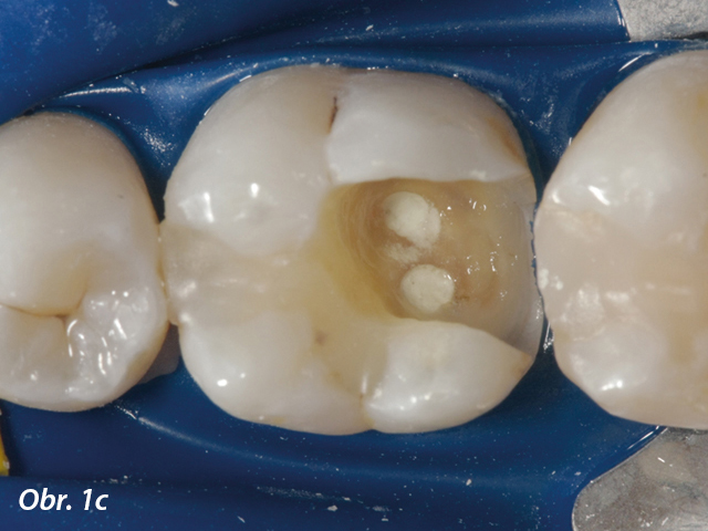 DT News - Czech Republic and Slovakia - Aplikace MTA s použitím Produit ...
