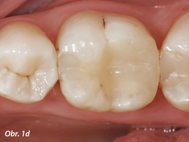 DT News - Czech Republic and Slovakia - Aplikace MTA s použitím Produit ...