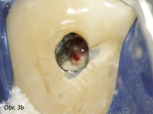 DT News - Czech Republic and Slovakia - Aplikace MTA s použitím Produit ...