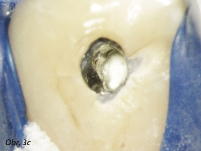 DT News - Czech Republic and Slovakia - Aplikace MTA s použitím Produit ...