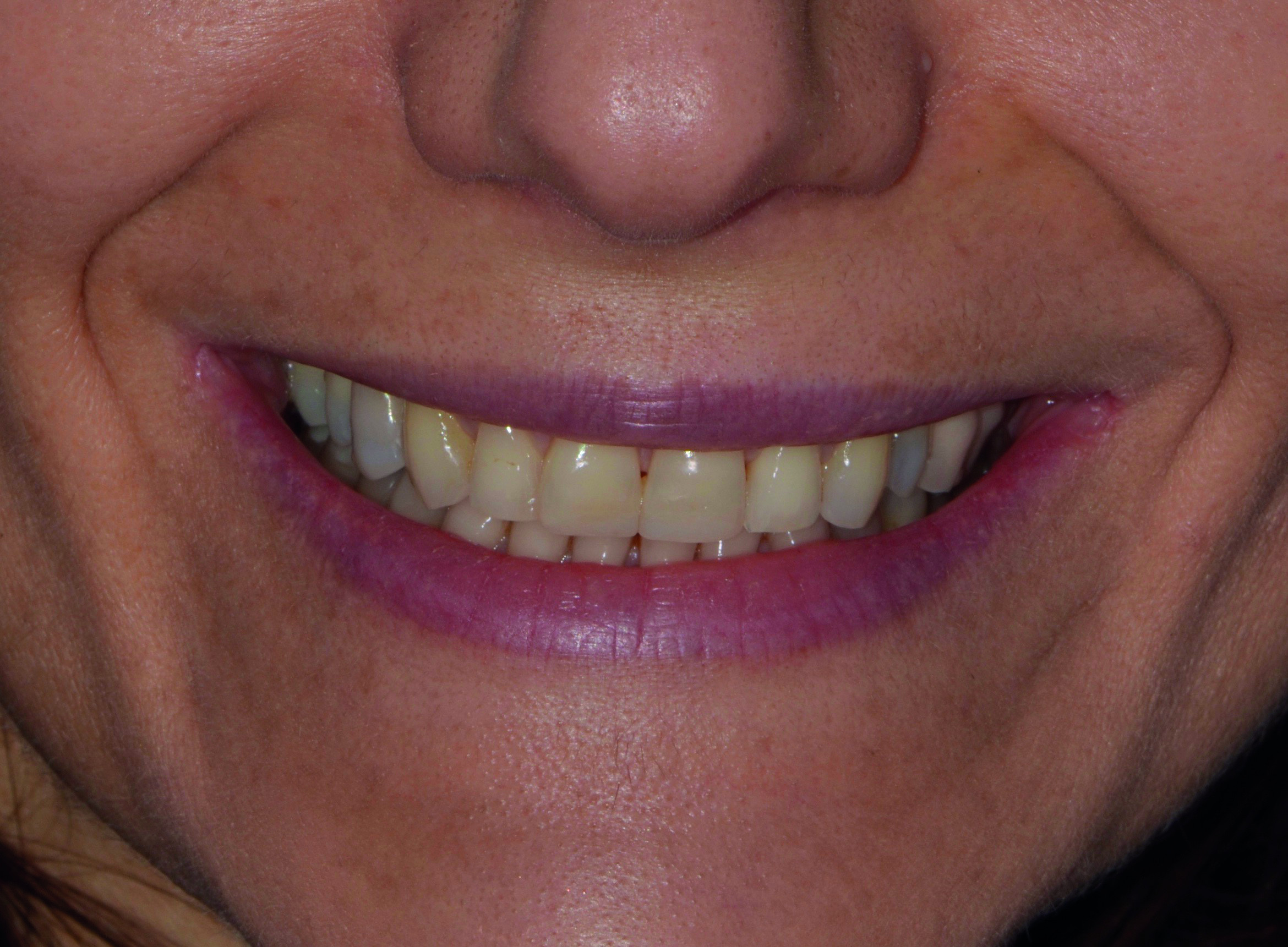Dental News - Aesthetic Digital Smile Design: 2-D-/3-D-assisted ...