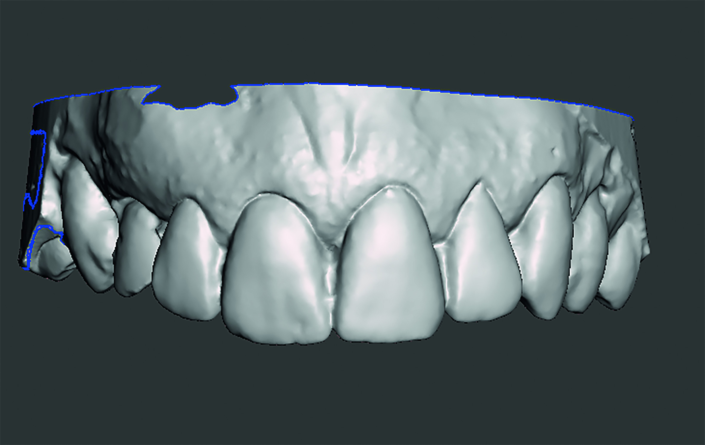 Dental News - Aesthetic Digital Smile Design: 2-D-/3-D-assisted ...