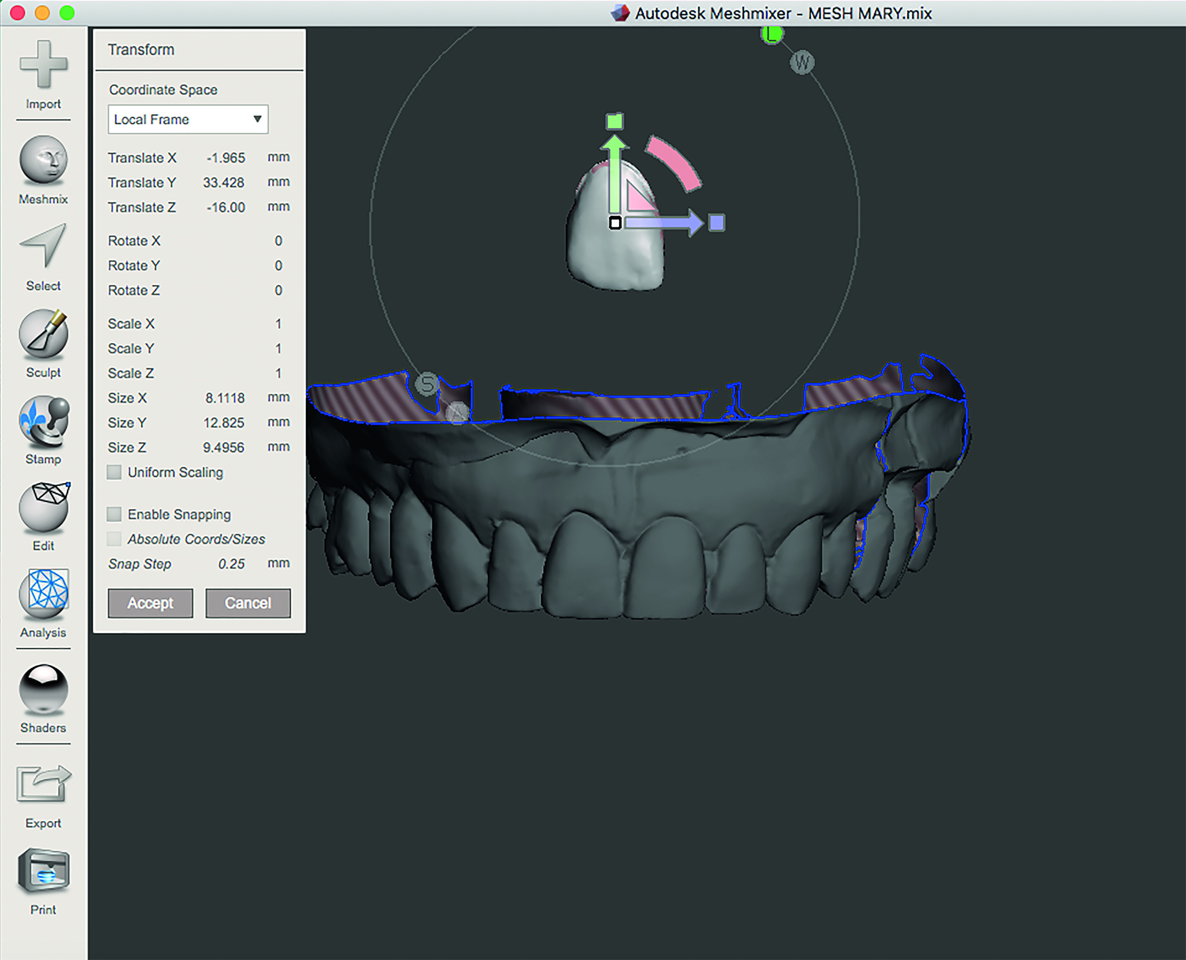Dental News - Aesthetic Digital Smile Design: 2-D-/3-D-assisted ...