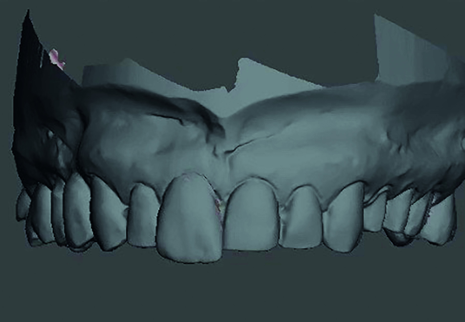 Dental News - Aesthetic Digital Smile Design: 2-D-/3-D-assisted ...