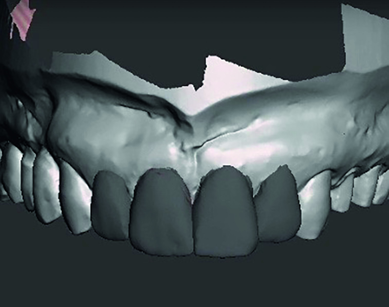 Dental News - Aesthetic Digital Smile Design: 2-D-/3-D-assisted ...