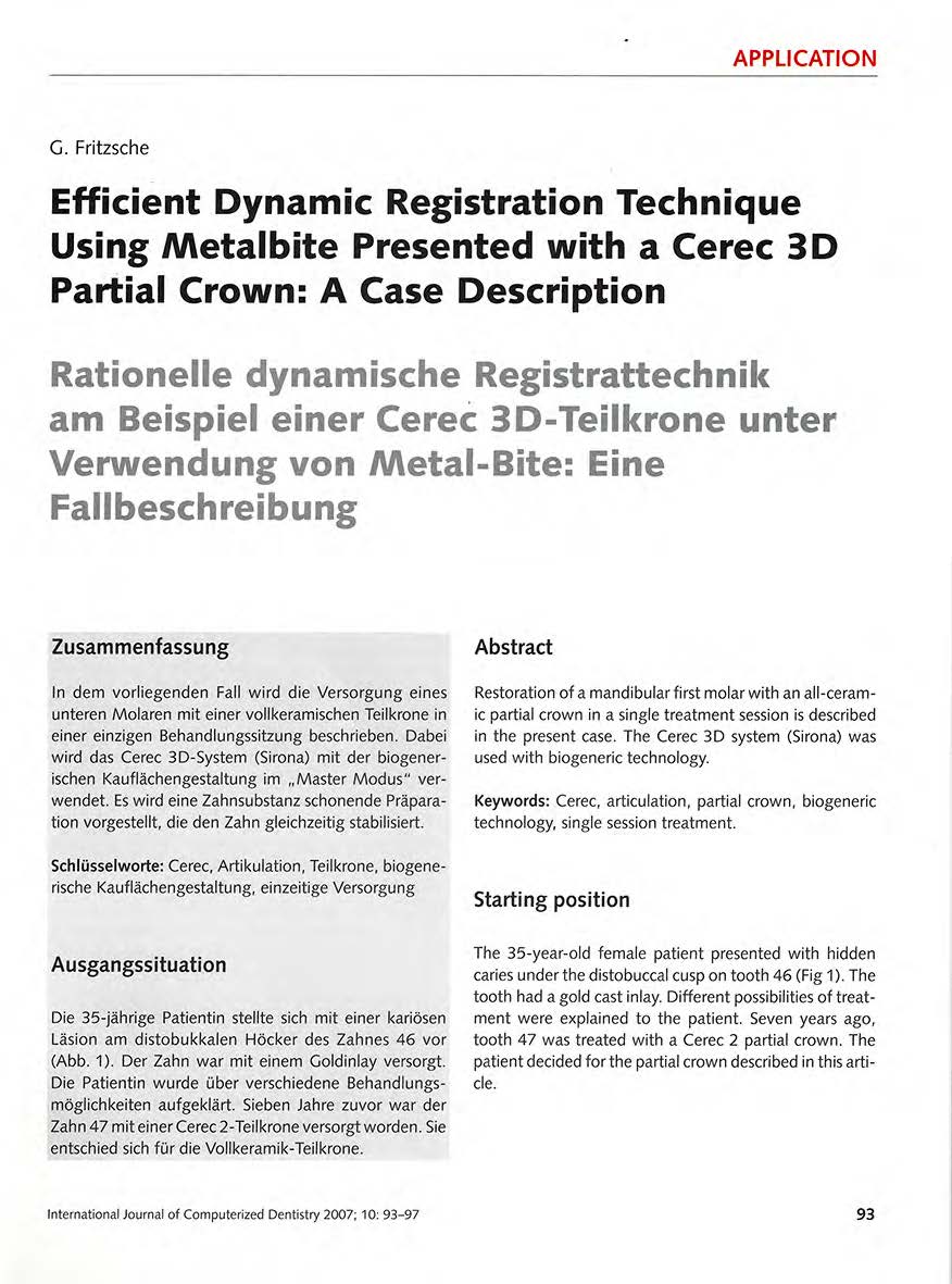 Efficient Dynamic Registration Technique Using Metal Bite.