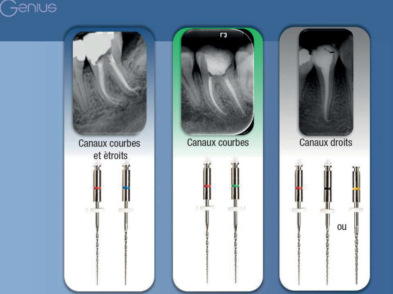 DT News - France - Le système Genius : moteur et limes pour mouvement ...