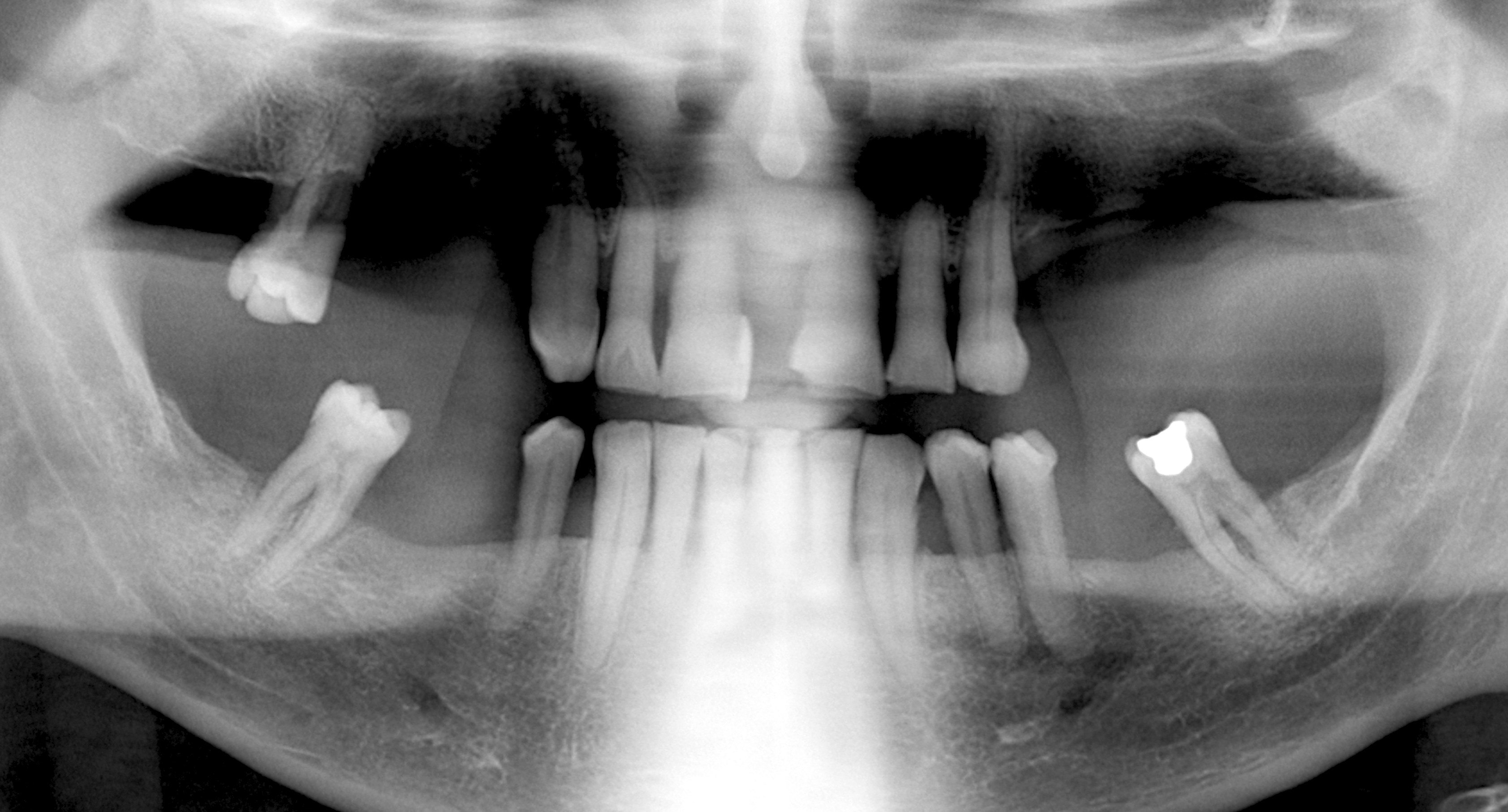 Dental News - The fully digital Pro Arch protocol