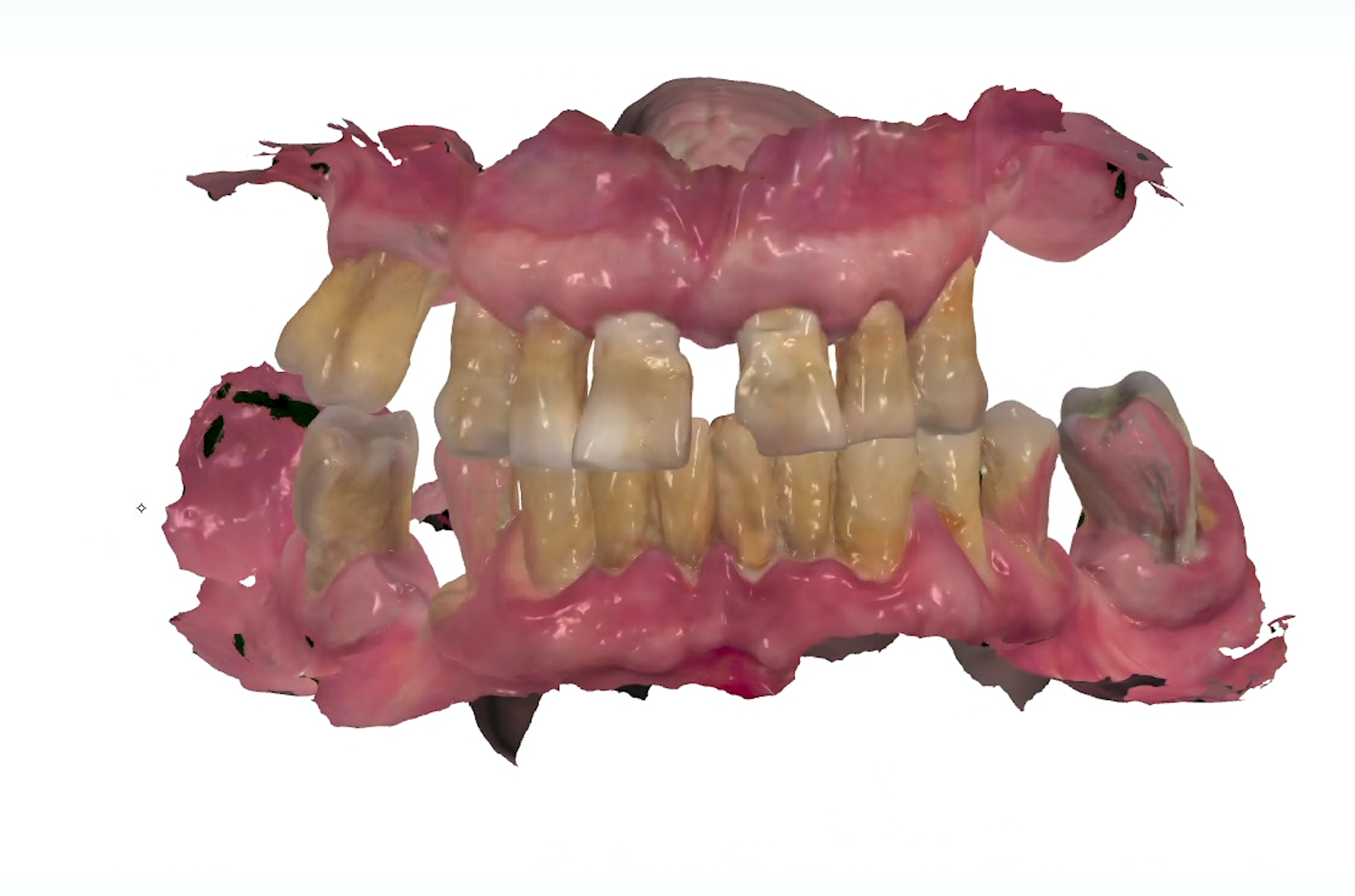 Dental News - The fully digital Pro Arch protocol
