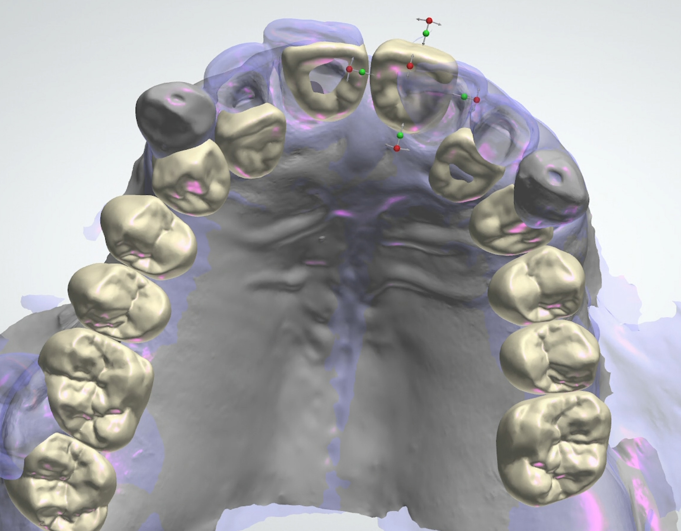 Dental News - The fully digital Pro Arch protocol