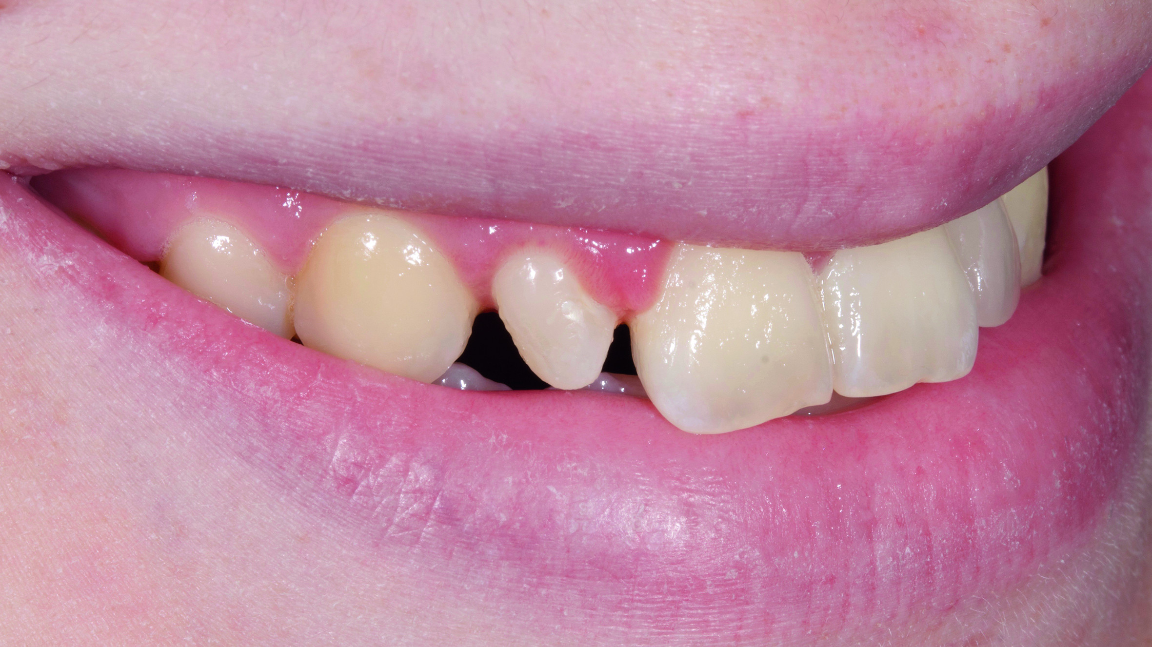 Dental News - The complete digital implant workflow