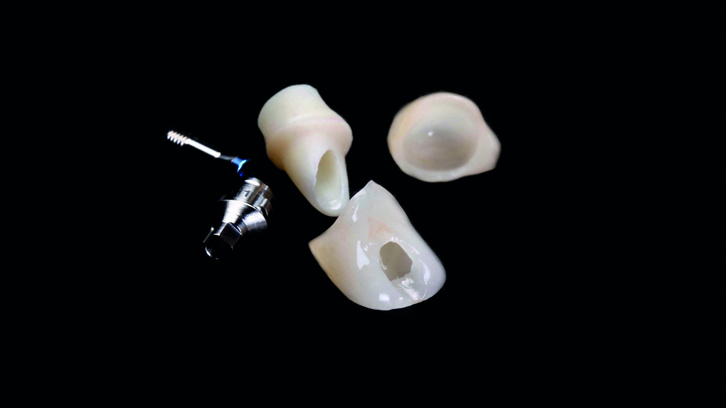Dental News - The complete digital implant workflow