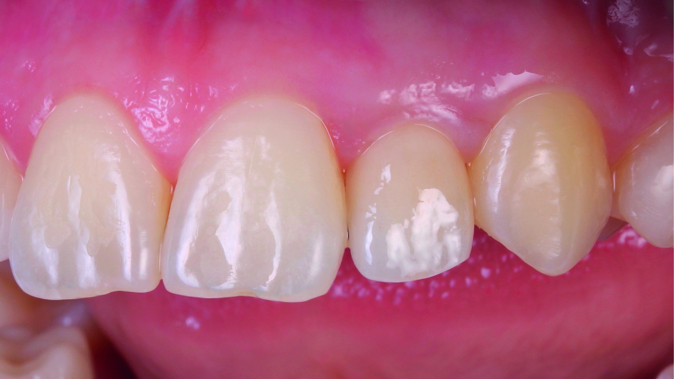Dental News - The complete digital implant workflow