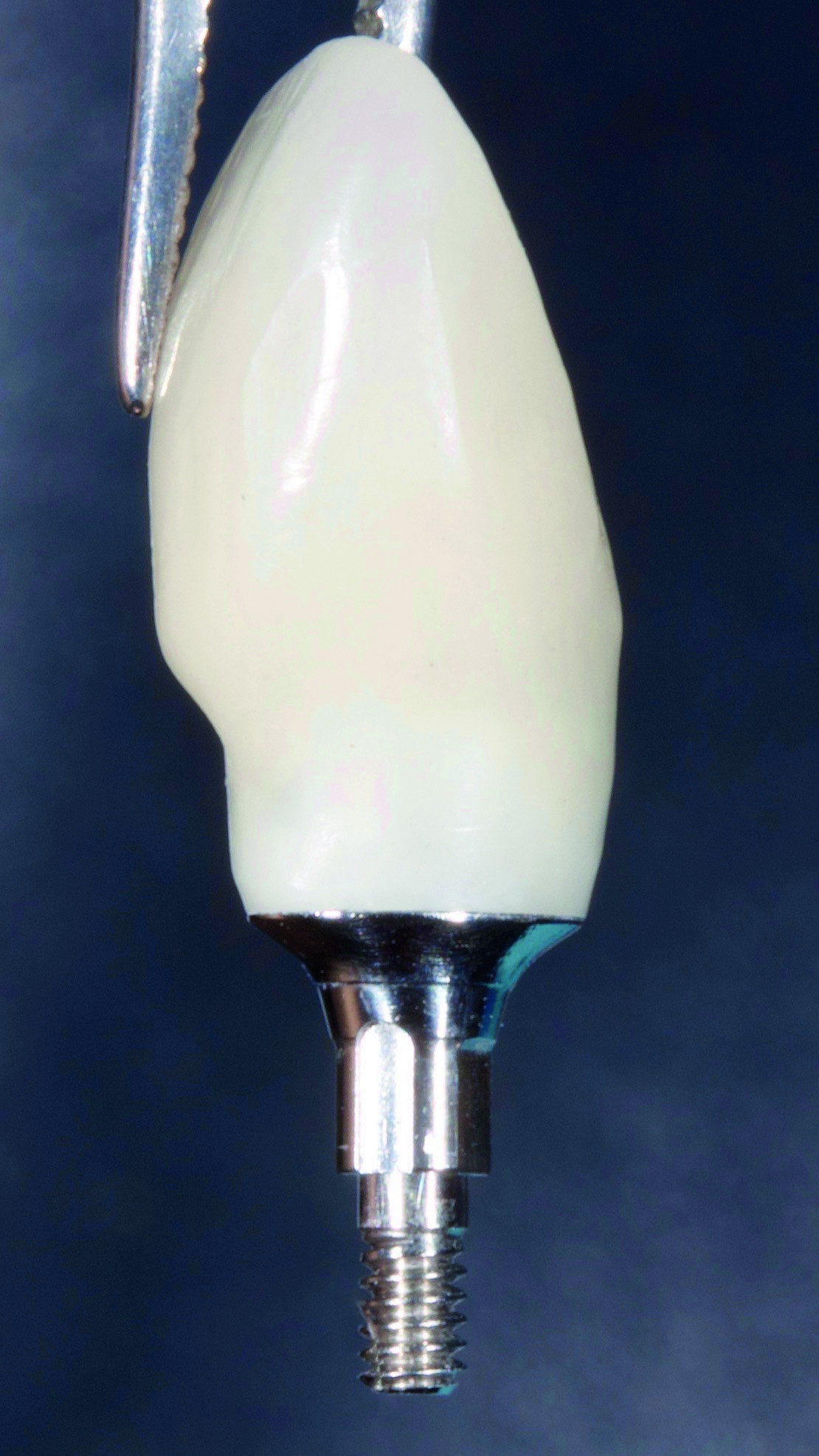 Dental News - The complete digital implant workflow