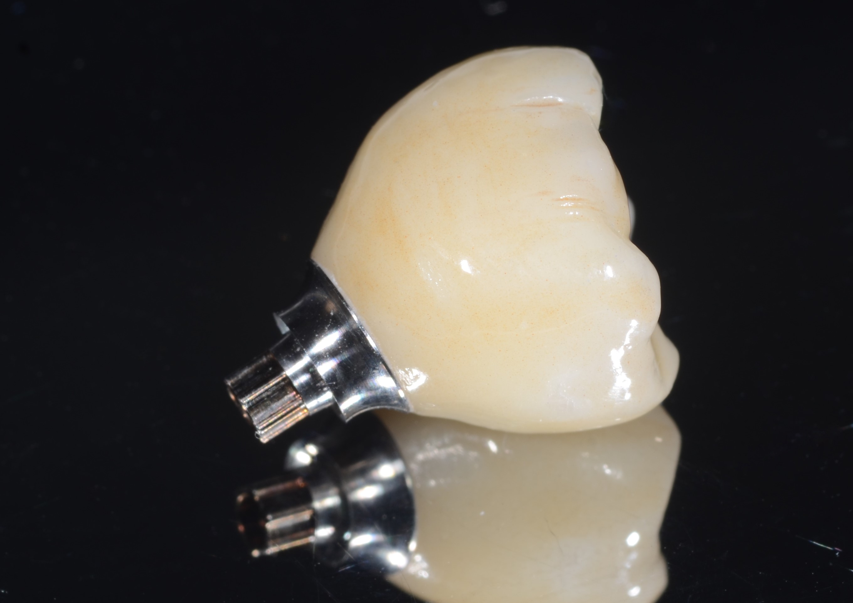 Dental News - Straumann BLX implant: First human case study yields ...