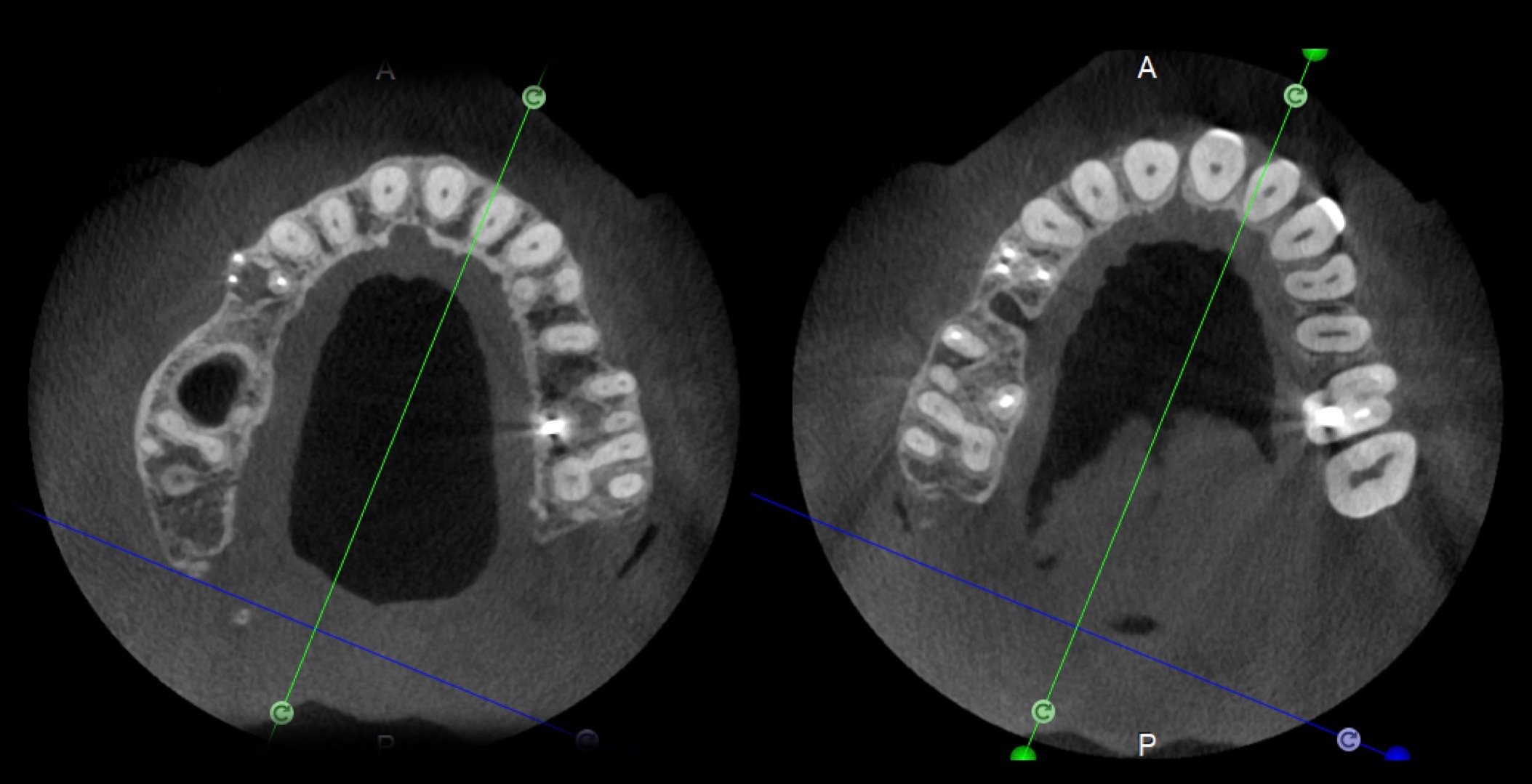 Dental News - Use of 3D technology in the diagnosis and treatment of ...