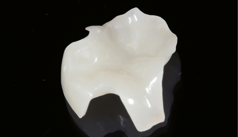 DT News - MEA - Easy and efficient: Composite resin blocks for the CAD ...