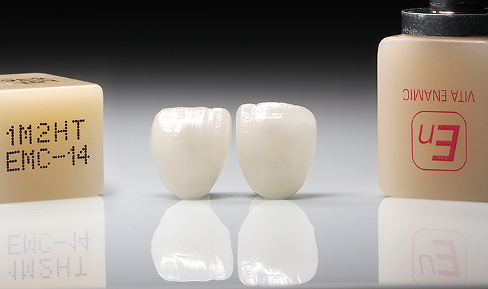 DT News - MEA - Minimally invasive veneer restoration with hybrid ceramics