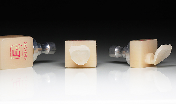 DT News - MEA - Minimally invasive veneer restoration with hybrid ceramics