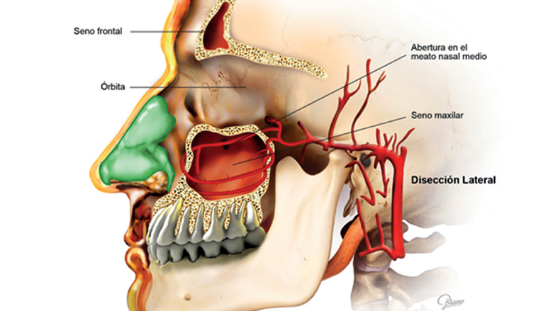 Anatomía Del Seno Nasal Nariz Y Senos Paranasales Anatomia | PPT