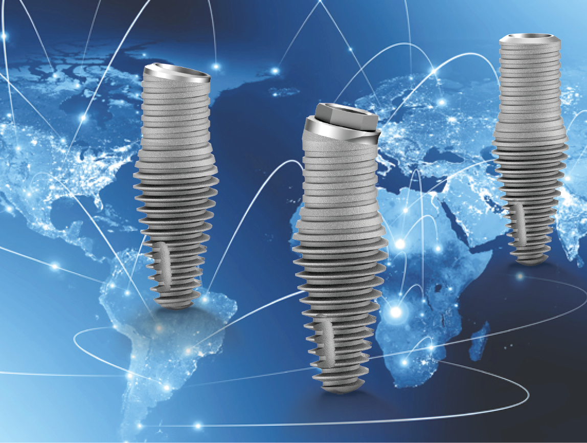 Southern Implants lance l’INVERTA en France