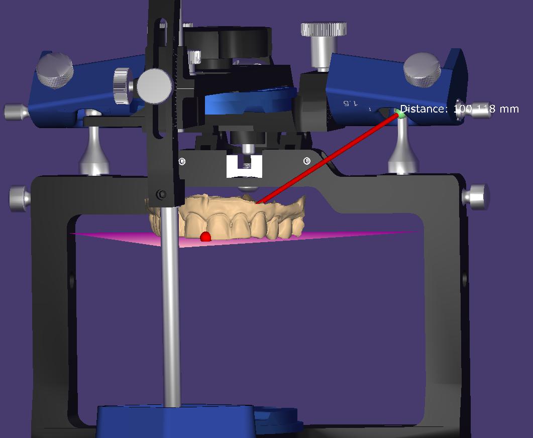 Dental News - Digital face-bow transfer technique dentofacial analyser ...