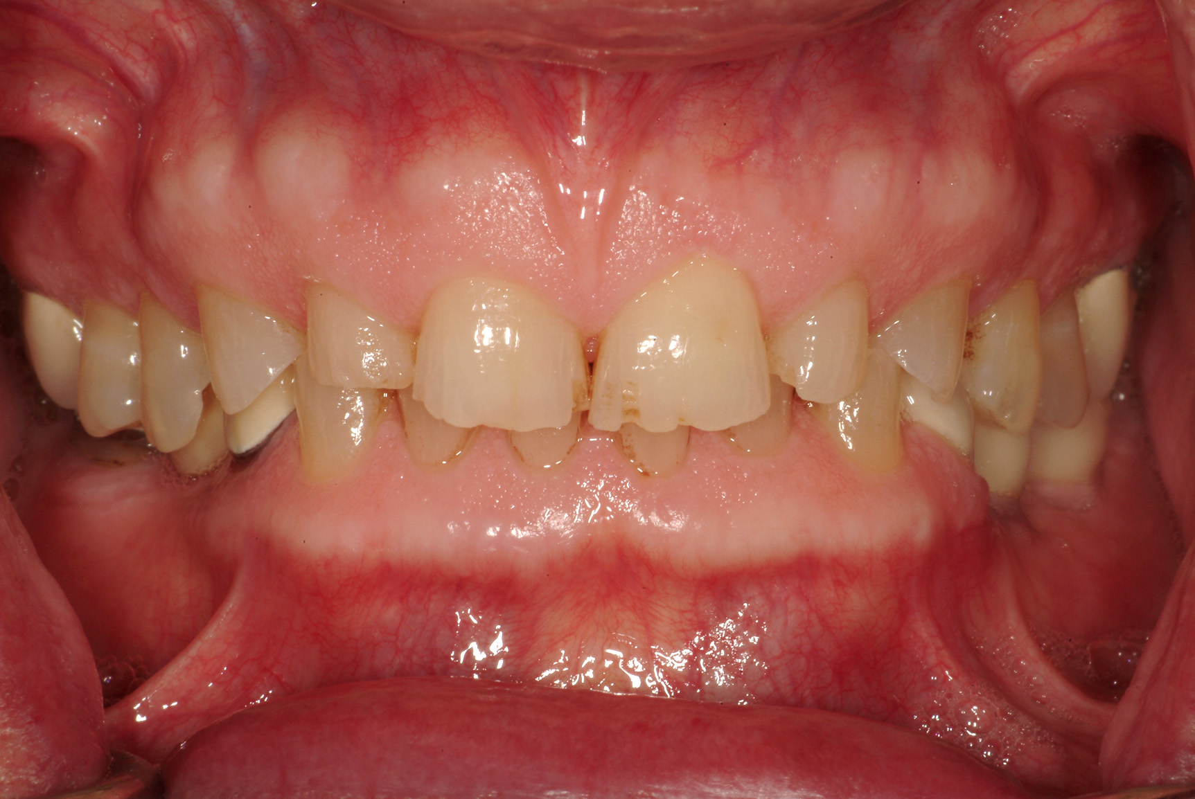 Dental News - Occlusion principles for the practising dentist in the ...