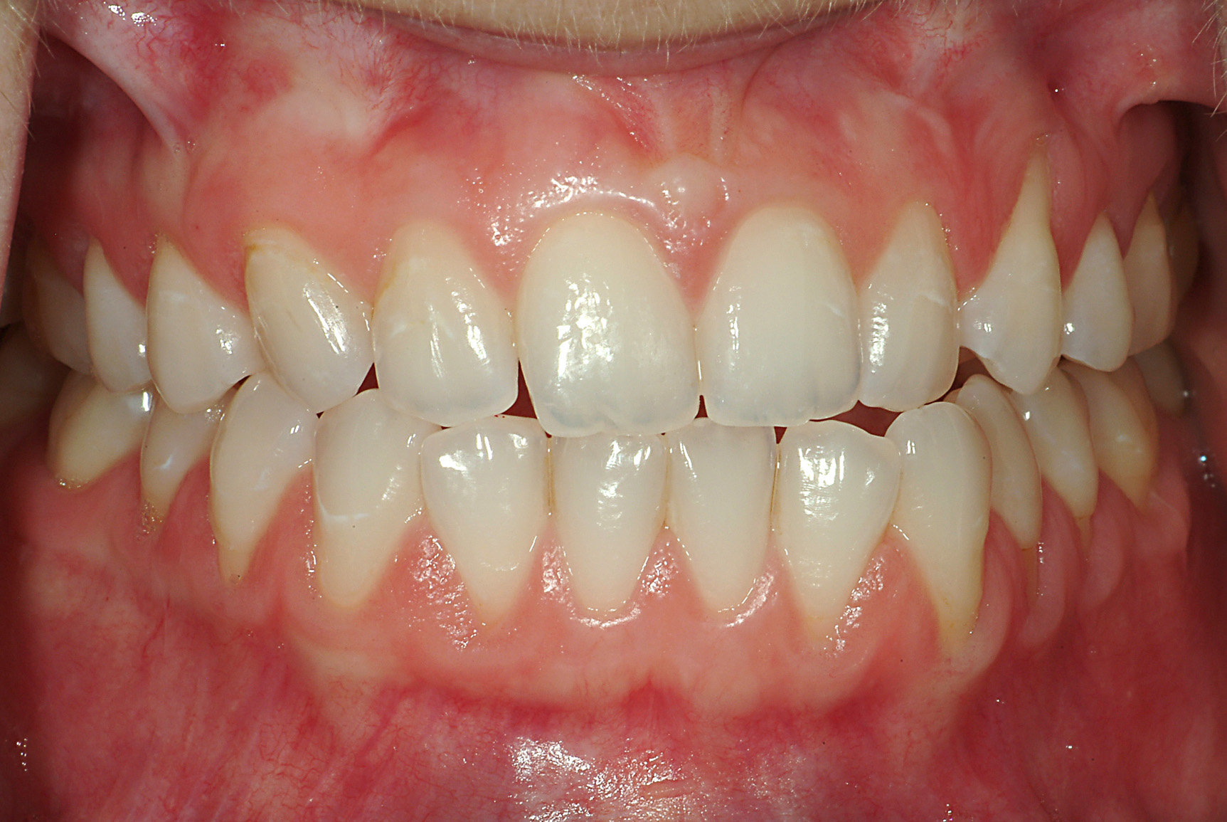Dental News - Occlusion principles for the practising dentist in the ...