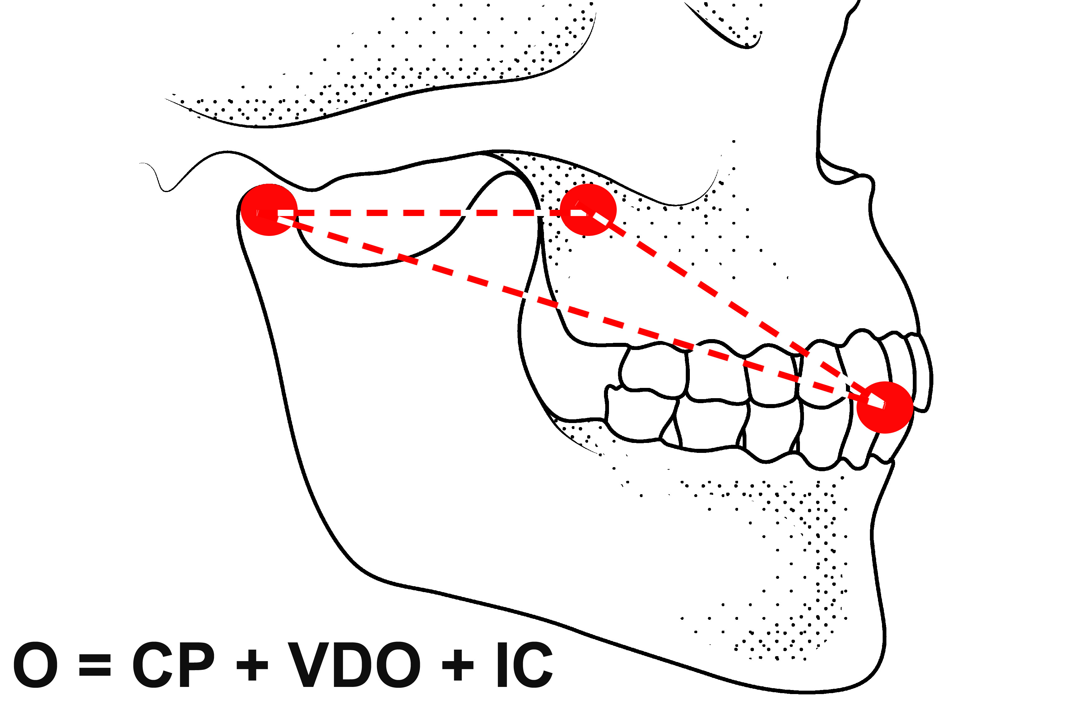 Occlusion principles for the practising dentist in the digital age