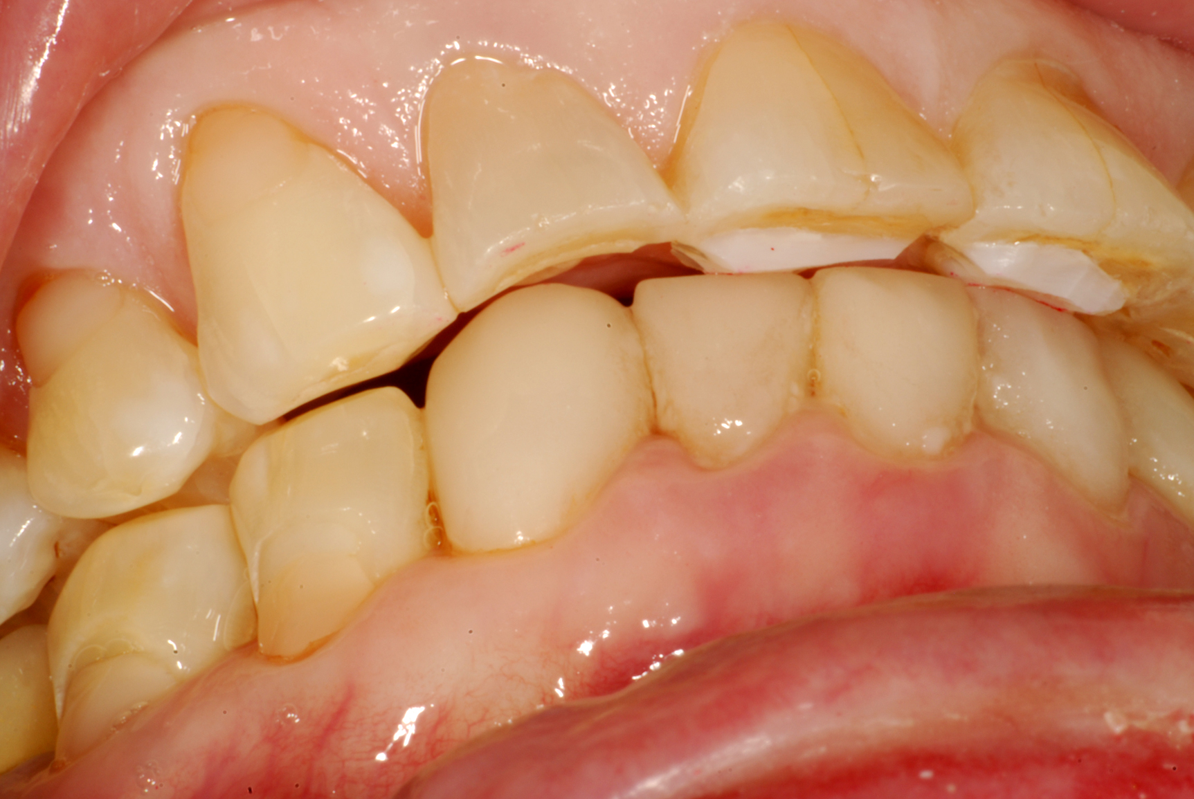 Occlusion principles for the practising dentist in the digital age