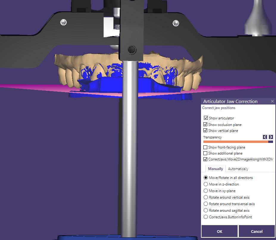 Dental News - Digital face-bow transfer technique dentofacial analyser ...