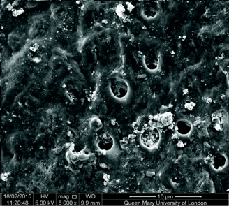 Dental News - Dentine hypersensitivity experience using toothpaste with ...