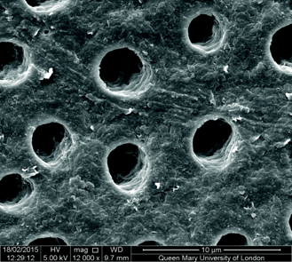 Dental News - Dentine hypersensitivity experience using toothpaste with ...