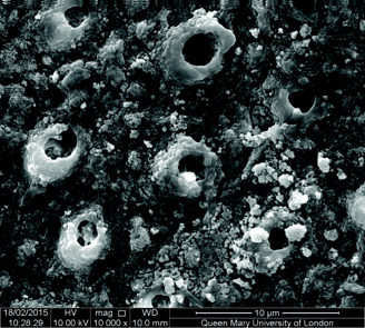 Dental News - Dentine hypersensitivity experience using toothpaste with ...