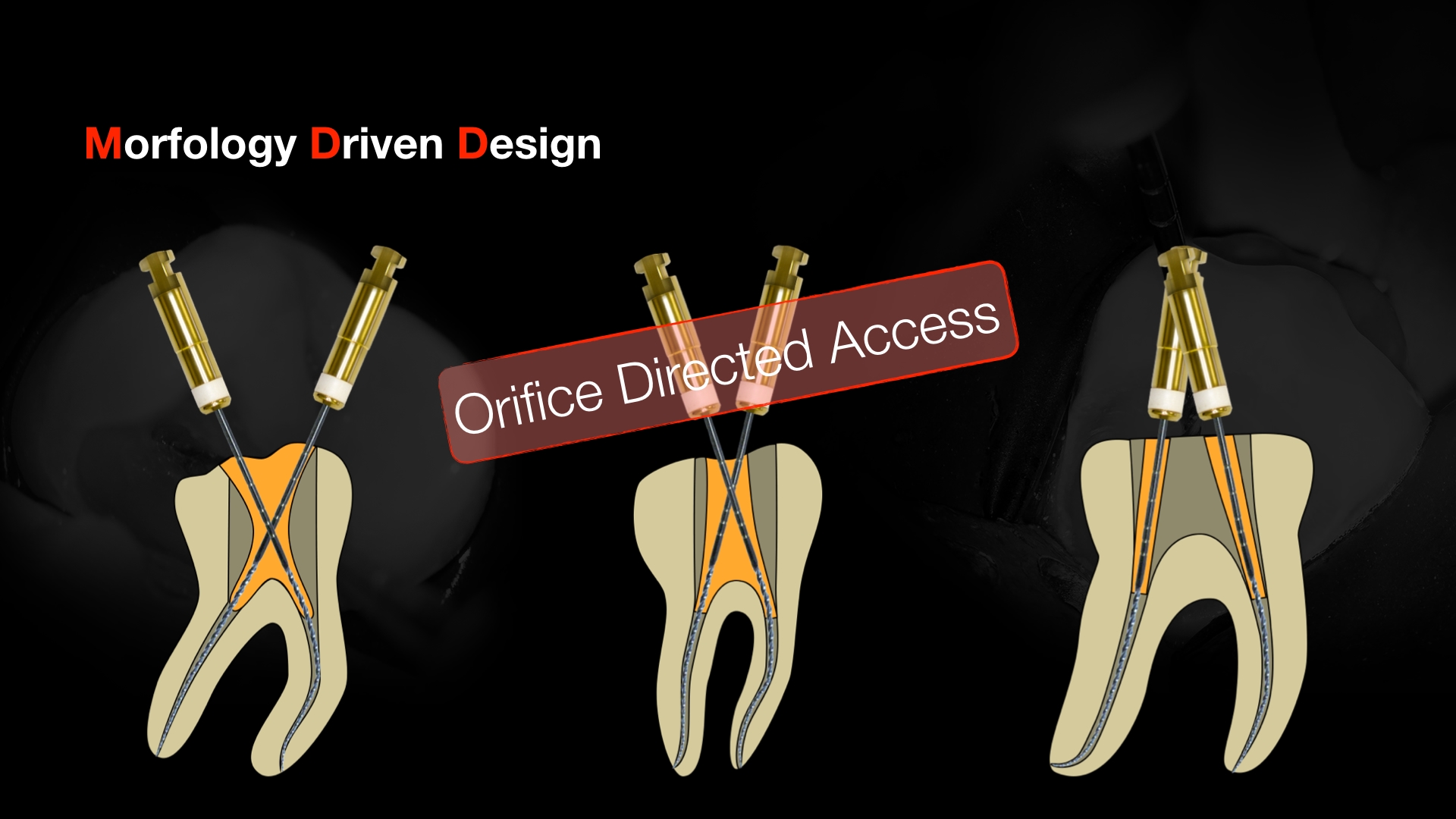Dental News - Guide to achieving fast and efficient precision in ...